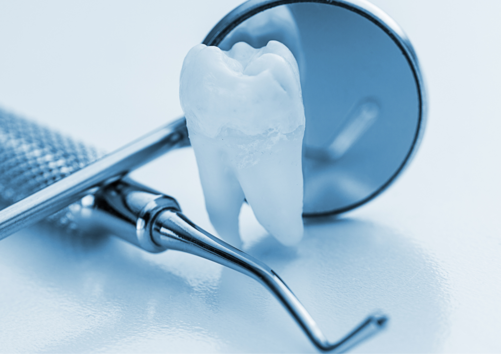 Understanding Metal Fillings: The Case Against Amalgam - Rosanna ...